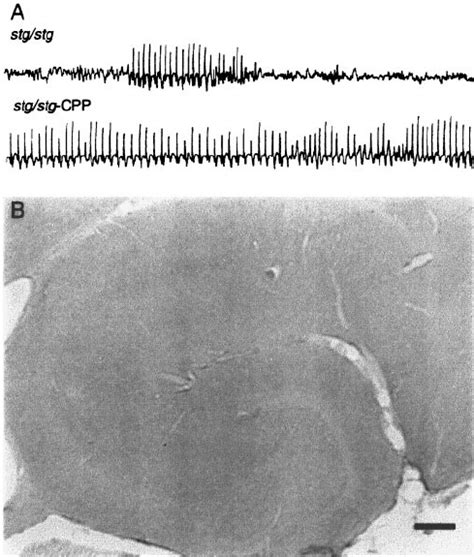 Stargazer Mice Demonstrate A Strong I Egp Response After Ka Induced Download Scientific Diagram