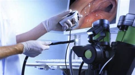 Ambalsoft Endoscopy Imaging Software At Best Price In Chennai Id 6662995188