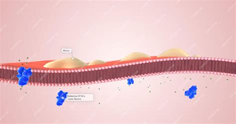 Premium Photo Cystic Fibrosis Is Caused By A Mutation In A Protein