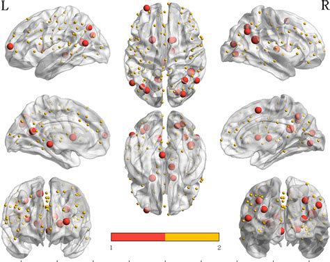 Altered Functional Connectivity And Topological Organization Nss