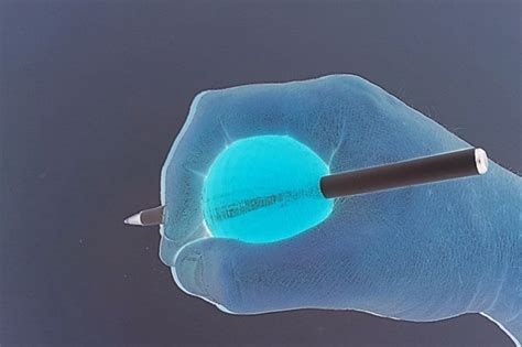 Stroke Victim Pen Holder Overview Wikifactory