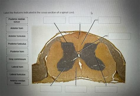 Solved Label The Features Indicated In The Cross Section Of