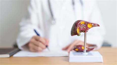 La Incidencia Del Cáncer De Hígado En Nuestro País Se Situará En 6695