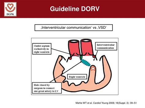 Ppt Dgpk Guideline Double Outlet Right Ventricle Dorv Powerpoint