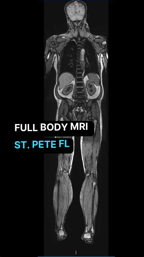 Part Of What Makes Truescan So Unique And Revolutionary Is The Sheer