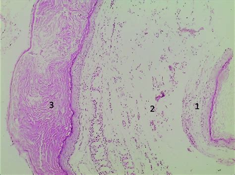 Biopsia De Piel Teñida Con Hematoxilina Y Eosina Con Aumento De 4x 1
