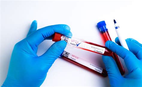 Monkey Pox Test Stock Photos Free Royalty Free Stock Photos From Dreamstime