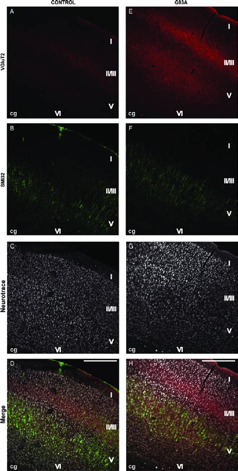 Distribution Of Vglut2 In The Different Motor Cortex M1 Layers Of The