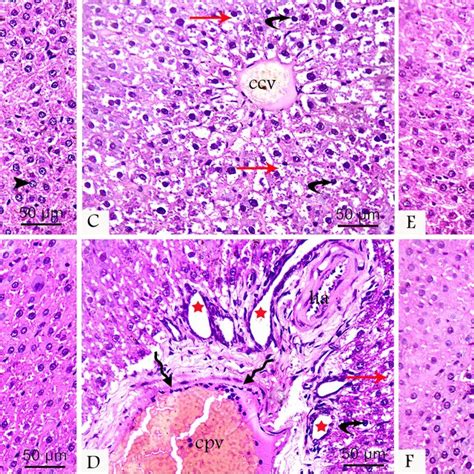 Hande Stained Liver Tissue Sections At 400 × Magnifications From All