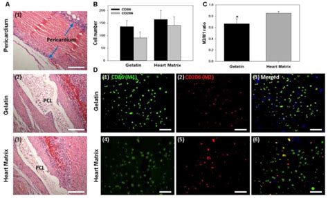 Full Thickness Heart Repair With An Engineered Multilayered Myocardial