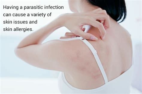 10 Symptoms Of Parasitic Infection Emedihealth Skin Parasites