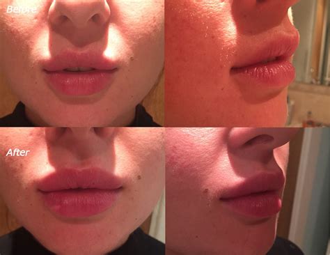 Aesthetic Treatmentslondon London