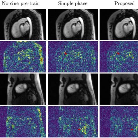Fpp Image Slices For Different Transfer Learning Methods Download Scientific Diagram