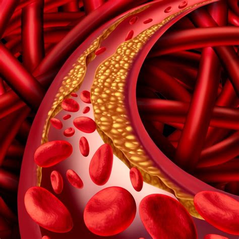 Rethinking Ldl Cholesterol Insights From Recent Research Symbios Health