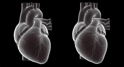 Ai Powered Mammograms Reveal Hidden Cardiovascular Risks Offering Early Detection Of Heart