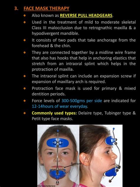 Class Iii Malocclusion Pptx