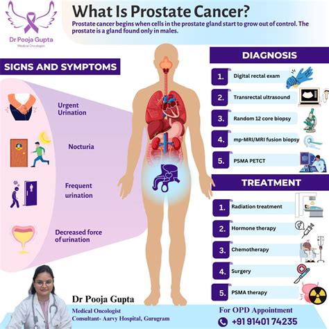 Dr Pooja Gupta On Linkedin 🩺 What Is Prostate Cancer 🩺 Prostate