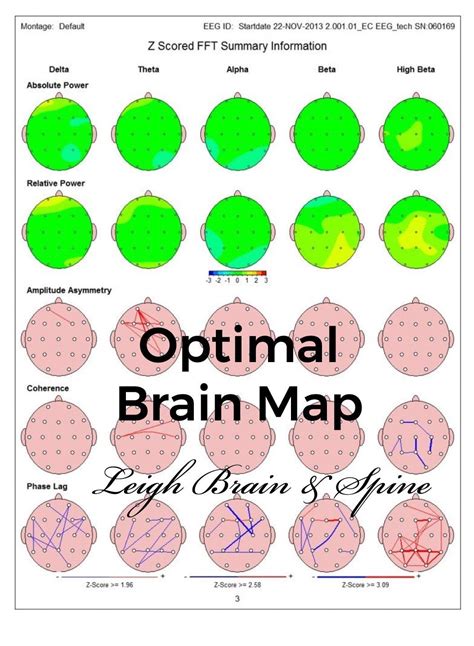 What A Normal Qeeg Brain Map Looks Like Leigh Brain And Spine