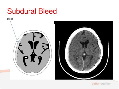 Ppt Ct For Adis Module Powerpoint Presentation Free Download Id