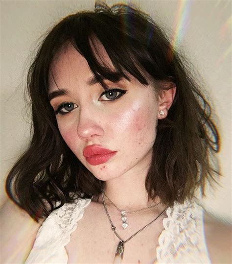 13 Inspiring Images That Prove Acne Is Not Ugly