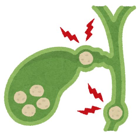 胆石のイラスト かわいいフリー素材集 いらすとや