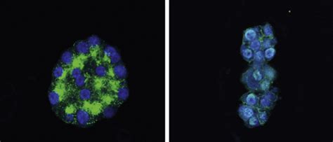 First Patient Derived Parathyroid Organoids Biotechniques