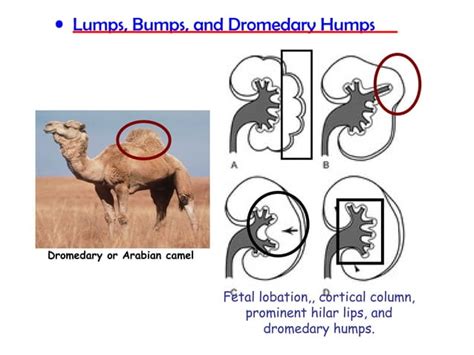 Red Flags For Neonatal Renal Disordersppt