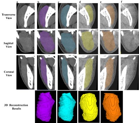 Examples Of Manual Segmentation On Ct And Cbct A F The Original Ct