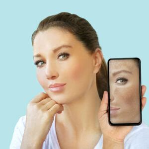 Como Escolher O Melhor Tratamento Para O Melasma Dra Melina