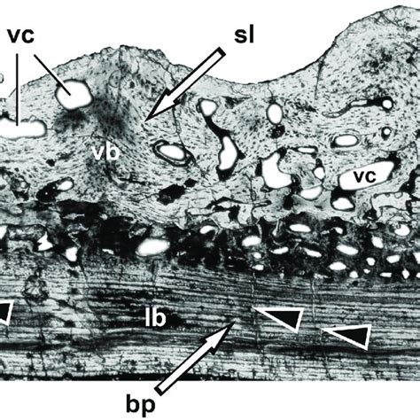 The Scales Of The Holoptychiid Porolepiform Holoptychius A