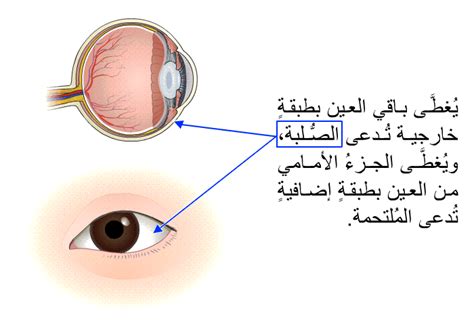 إصابات العين