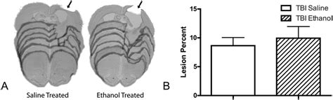 A Representative Nissl Stained Coronal Sections Of Saline Treated And