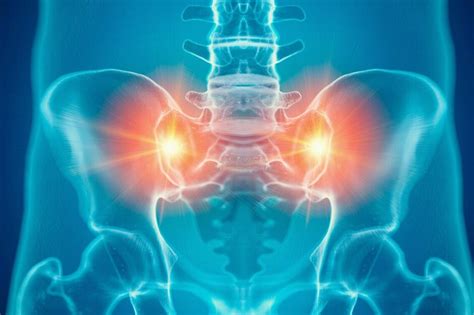 Physical Therapy For Sacroiliac Joint Dysfunction Mangiarelli