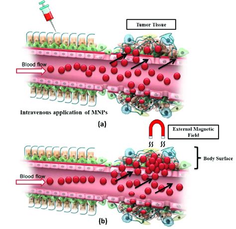 Magnetic Hyperthermia Therapy A Intravenous Application Of Mnps Into