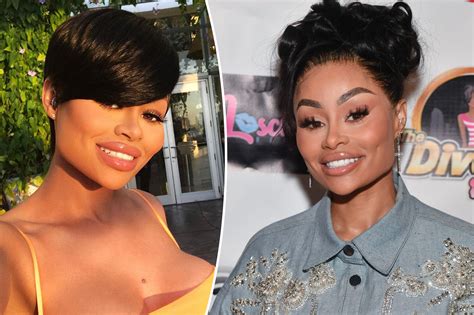Blac Chyna Steps Out After Dissolving Facial Fillers Butt Reduction
