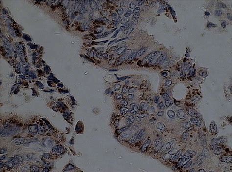 Non Radioactive Labeled In Situ Hybridization To Detect The Expression Download Scientific