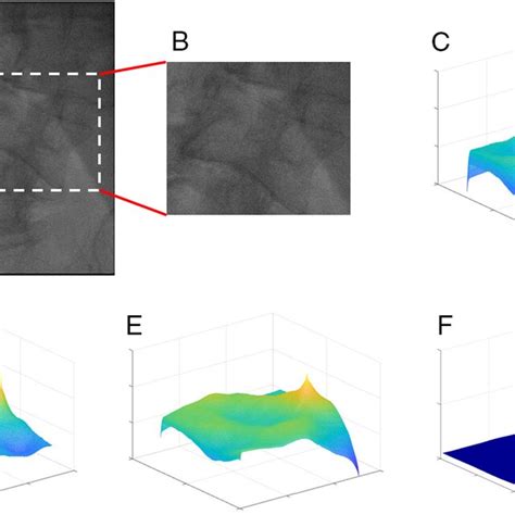 Optimization Using The Similarity Matrix A A Fixed Image—a Download Scientific Diagram