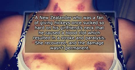 Sex Related Injuries That Will Make You Cringe EBaum S World