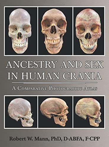 Ancestry And Sex In Human Crania A Comparative Photographic Atlas
