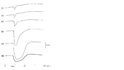 Typical Dc Potential Recording Showing Id On All Six Electrodes