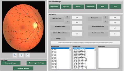 Distinct Bifurcation Points Shown In Red Dots Whereas Green Dots Are Download Scientific