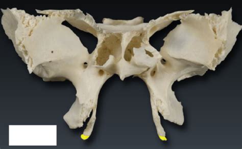 Anatomy Of The Hard Soft Palate Flashcards Quizlet