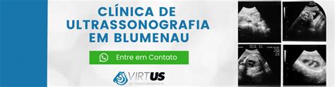 Quando O Exame De Ultrassom é Indicado Entenda