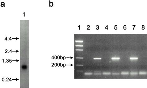 Expression And Sequence Analysis Of A Novel Histone H2a Variant