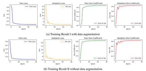 Brain Tumor Mri Images Classification And Segmentation Projects