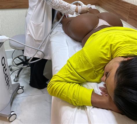 Gracyanne Barbosa realiza procedimento estético no bumbum