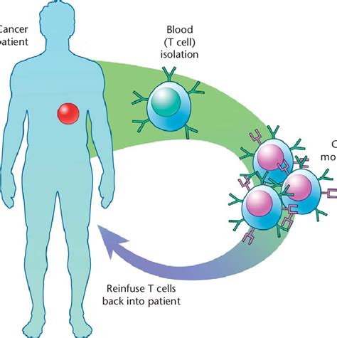 Generalized Scheme Of Adoptive Cell Transfer Act Of Genetically