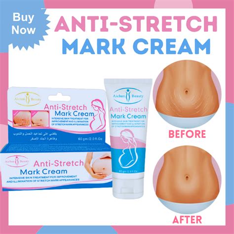 100 Effective Aichun Beauty Anti Stretch Mark Cream For Pregnant Woman