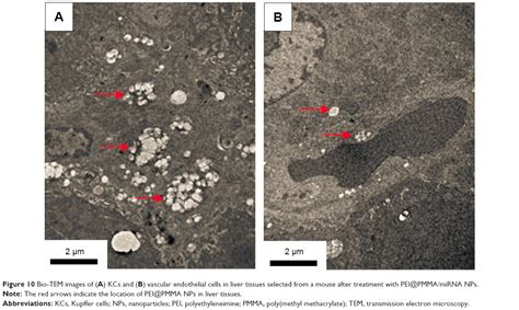 Amphiphilic Core Shell Nanoparticles Containing Dense Polyethyleneimin Ijn