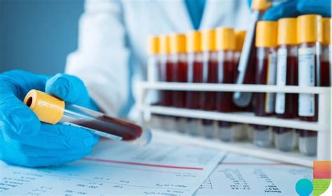 Enhancing Sample Traceability In Clinical Labs The